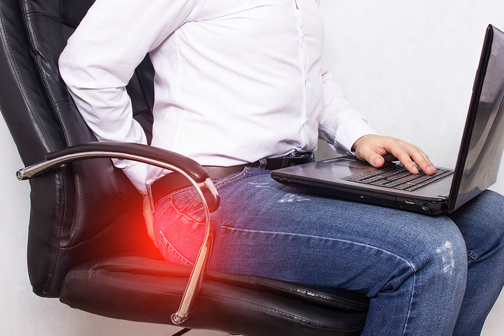 PROLASSO DEL RETTO - professorefrancescoselvaggi.it